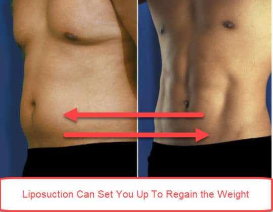 Liposuction in a jar - Painless flab loss